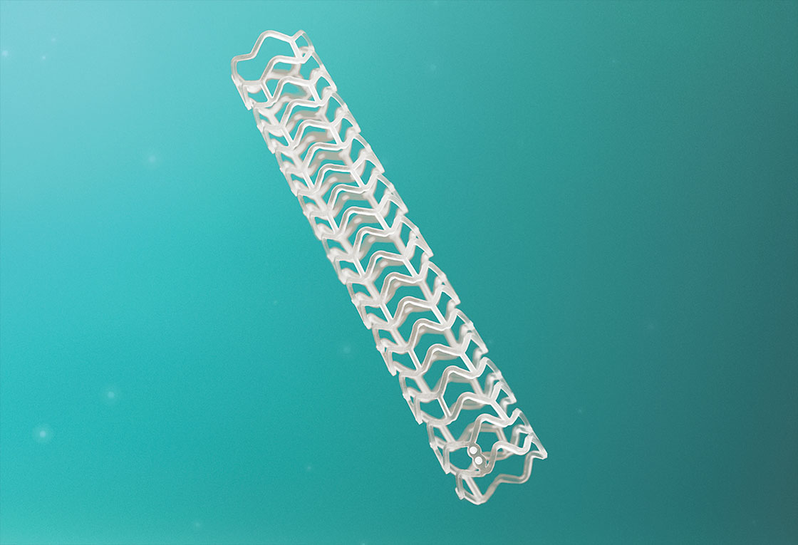 Heart Stents & Stent Surgery